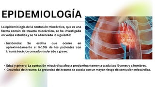Contusión Miocárdica | PPTX