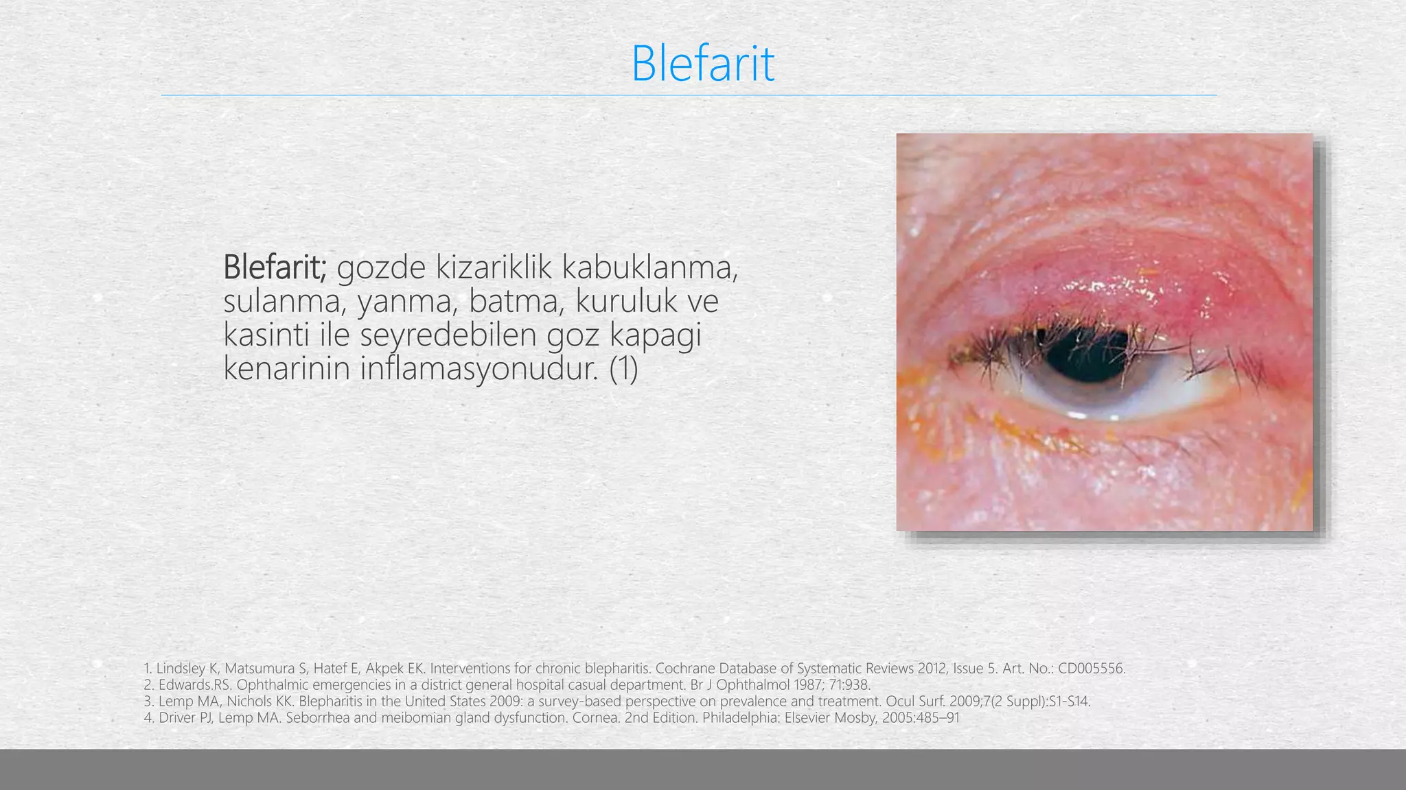 bekir ahmet blefarit.pptx