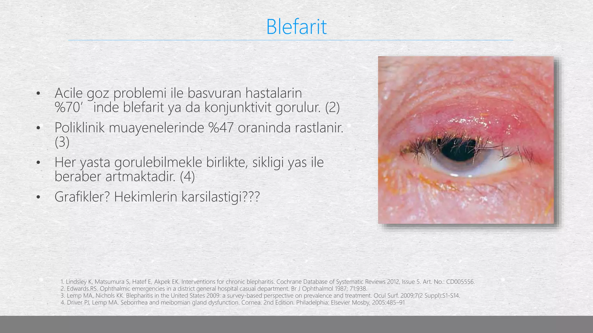 bekir ahmet blefarit.pptx