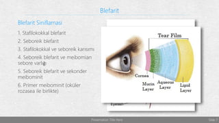 bekir ahmet blefarit.pptx