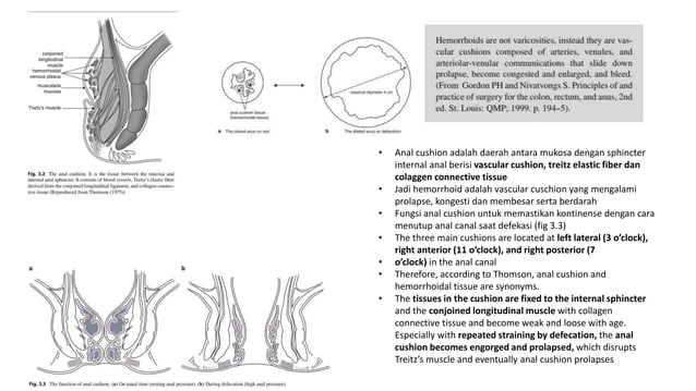 Belajar Hemorrhoid Lagi.pptx