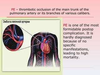 PULMONARY THROMBOEMBOLISM IN CANCER PATIENTS AFTER SURGERY | PPT