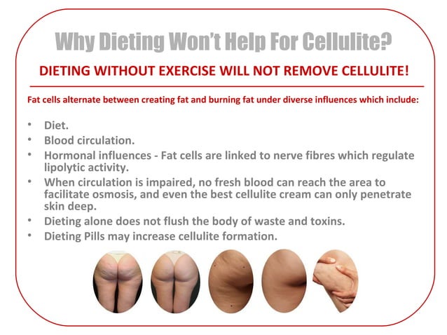 Cellulite treatment with cupping therapy massage by bellabaci | PPT