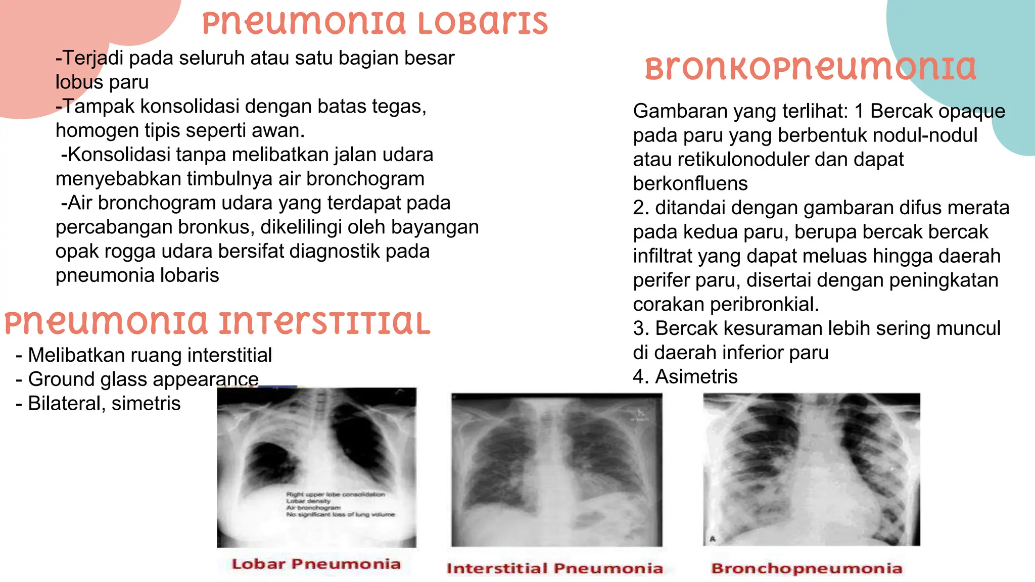 MANAJEMEN KASUS PNEUMONIA PADA ANAK.pptx