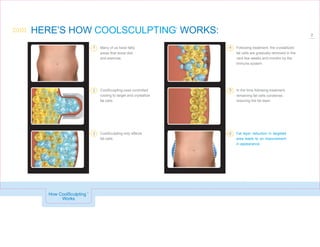 Coolsculpting /guidebook | PPTX