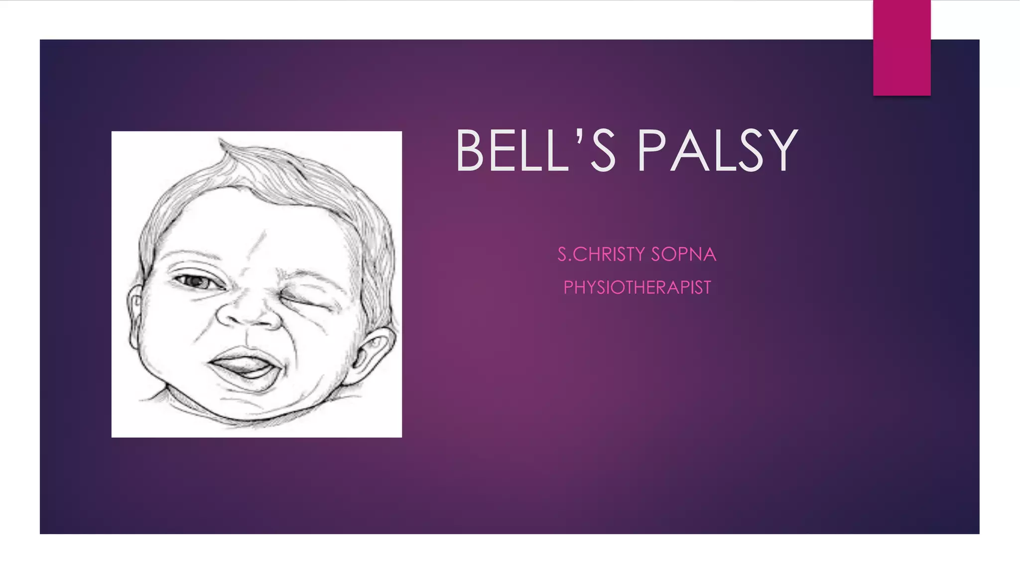 Bells Palsy Ppt