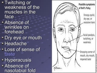 Bells palasy and it's hom | PPT