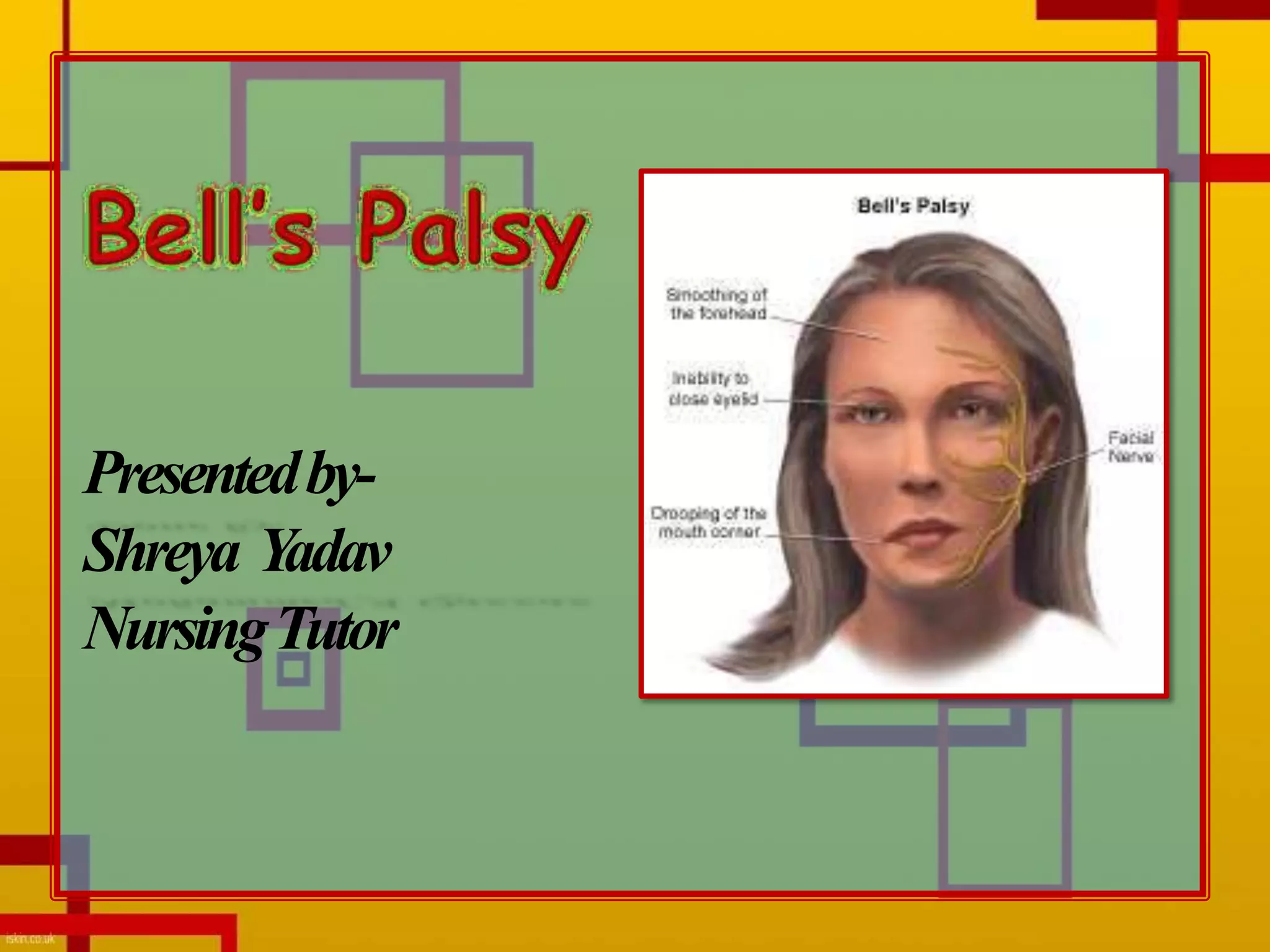 Bellspalsy 130915141951-phpapp02-converted | PPTX | Ear, Nose and ...