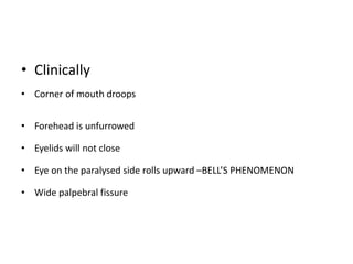 Bells palsy | PPTX