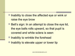Bell's palsy / dental courses | PPT