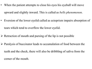 Bells palsy | PPTX