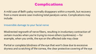 Bells palsy-causes |management |a brief medical study | PPTX