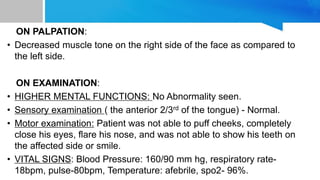 Bells palsy | PPTX