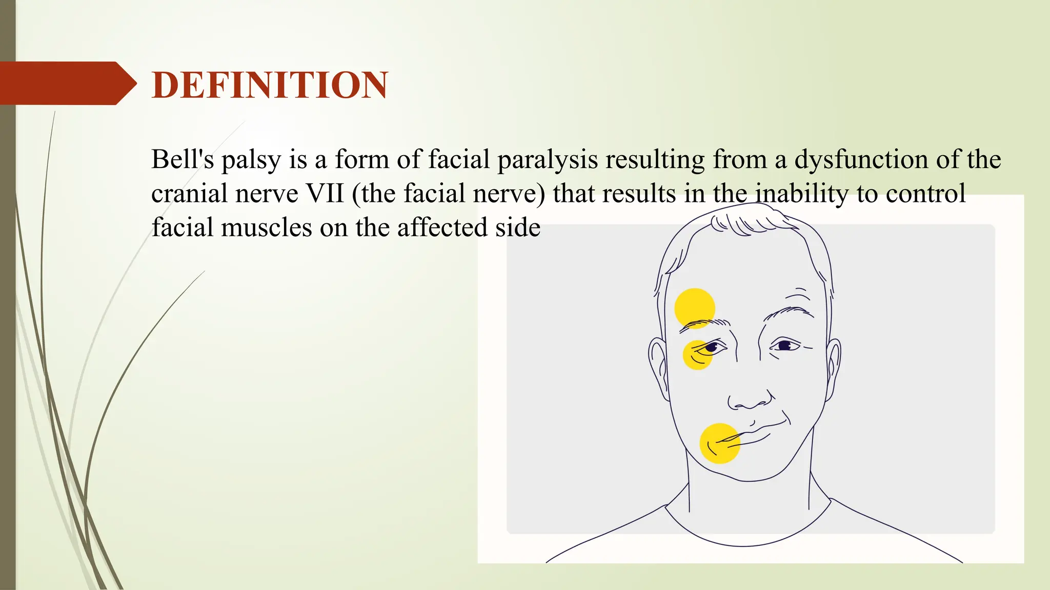 Bell's Palsy, unit - VI for Nursing.pptx