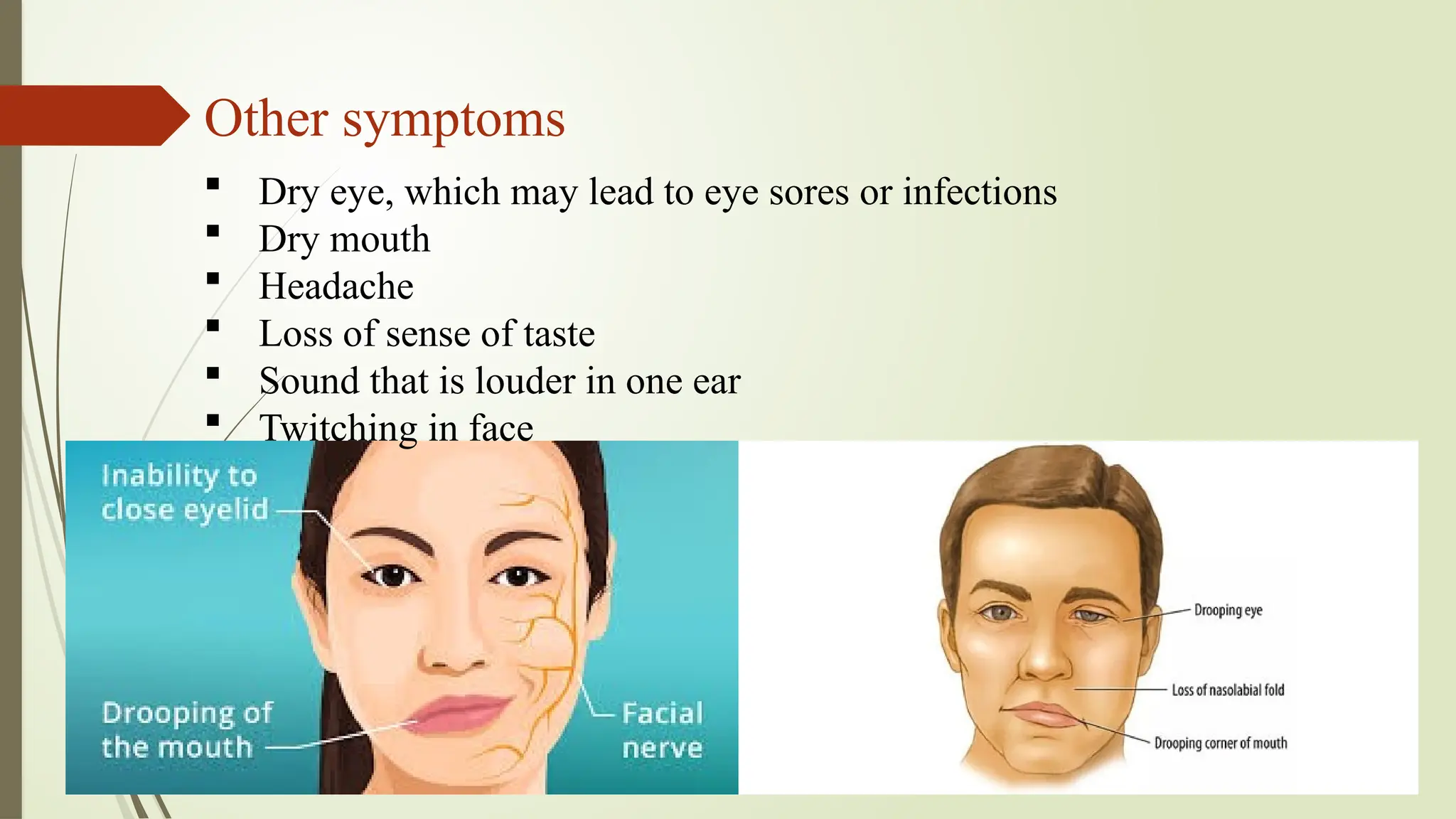 Bell's Palsy, unit - VI for Nursing.pptx