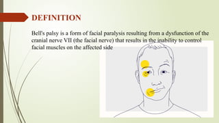Bell's Palsy, unit - VI for Nursing.pptx