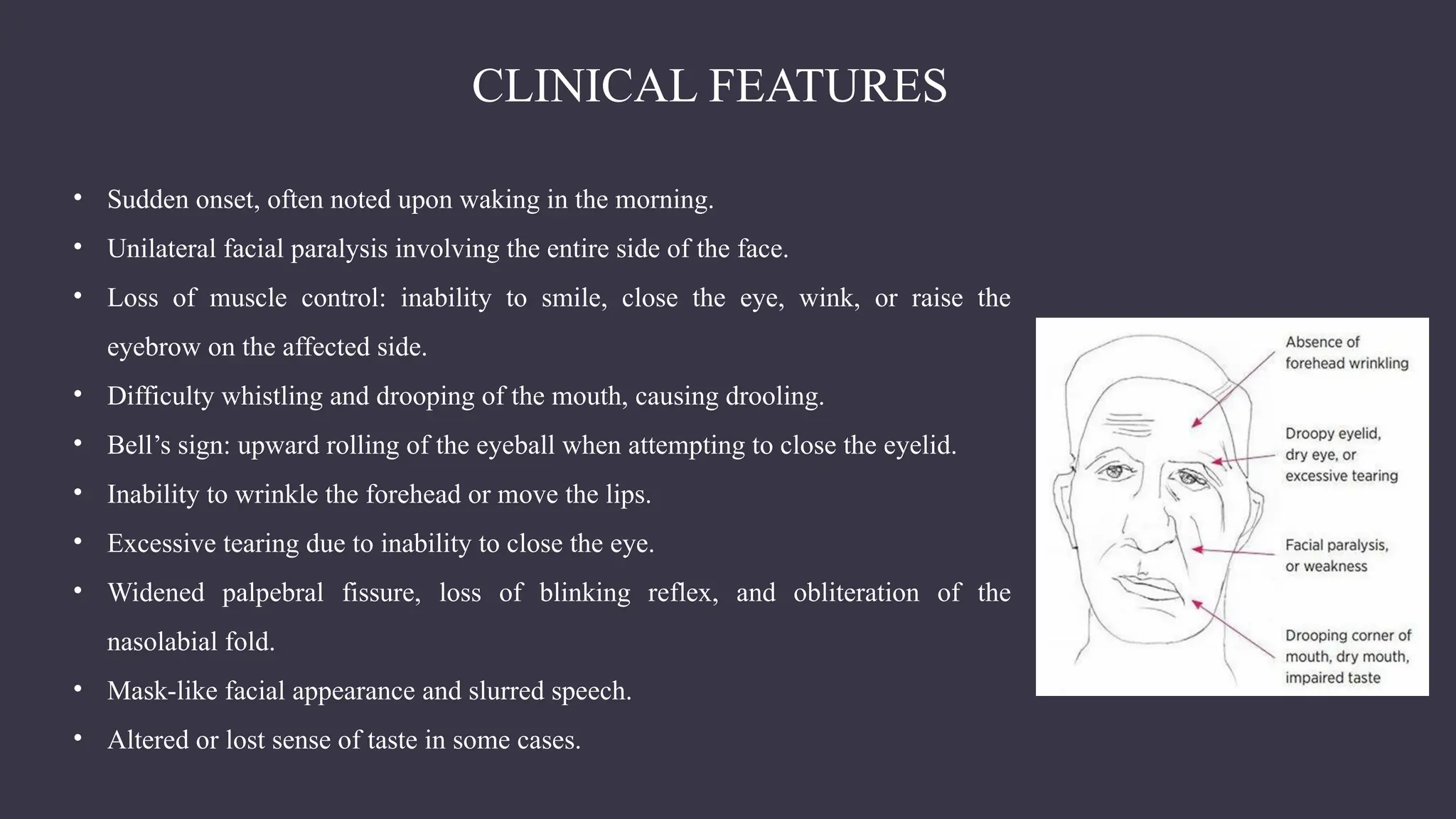 bells palsy.pptxNerve Injuries from Mandibular Third Molar Removal ...