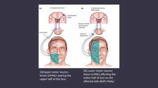 bells palsy.pptxNerve Injuries from Mandibular Third Molar Removal ...