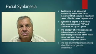 Bell's Palsy | PPTX