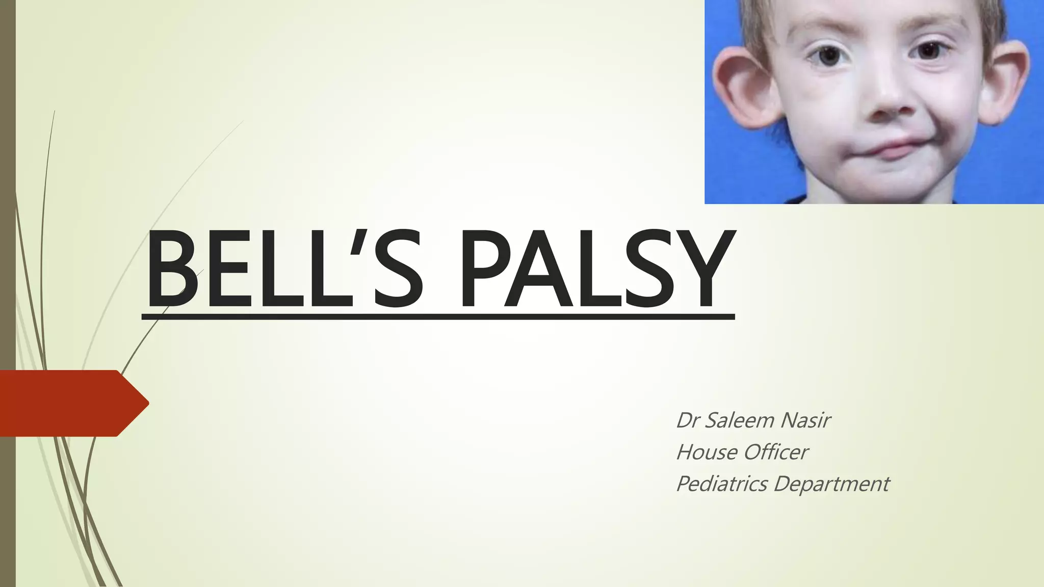 BELL’S PALSY Dr Saleem Peads.pptx