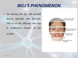 PHYSIOTHERAPY TREATMENT FOR BELL'S PALSY | PPTX | Physical Therapy ...