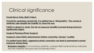 Bell's phenomenon anatomy mechanism clinical significance | PPTX
