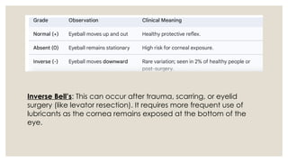 Bell's phenomenon anatomy mechanism clinical significance | PPTX