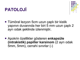 intrakistik papiller meme kanseri | PPT