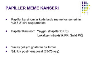 intrakistik papiller meme kanseri | PPT