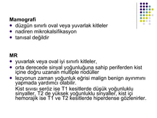intrakistik papiller meme kanseri | PPT