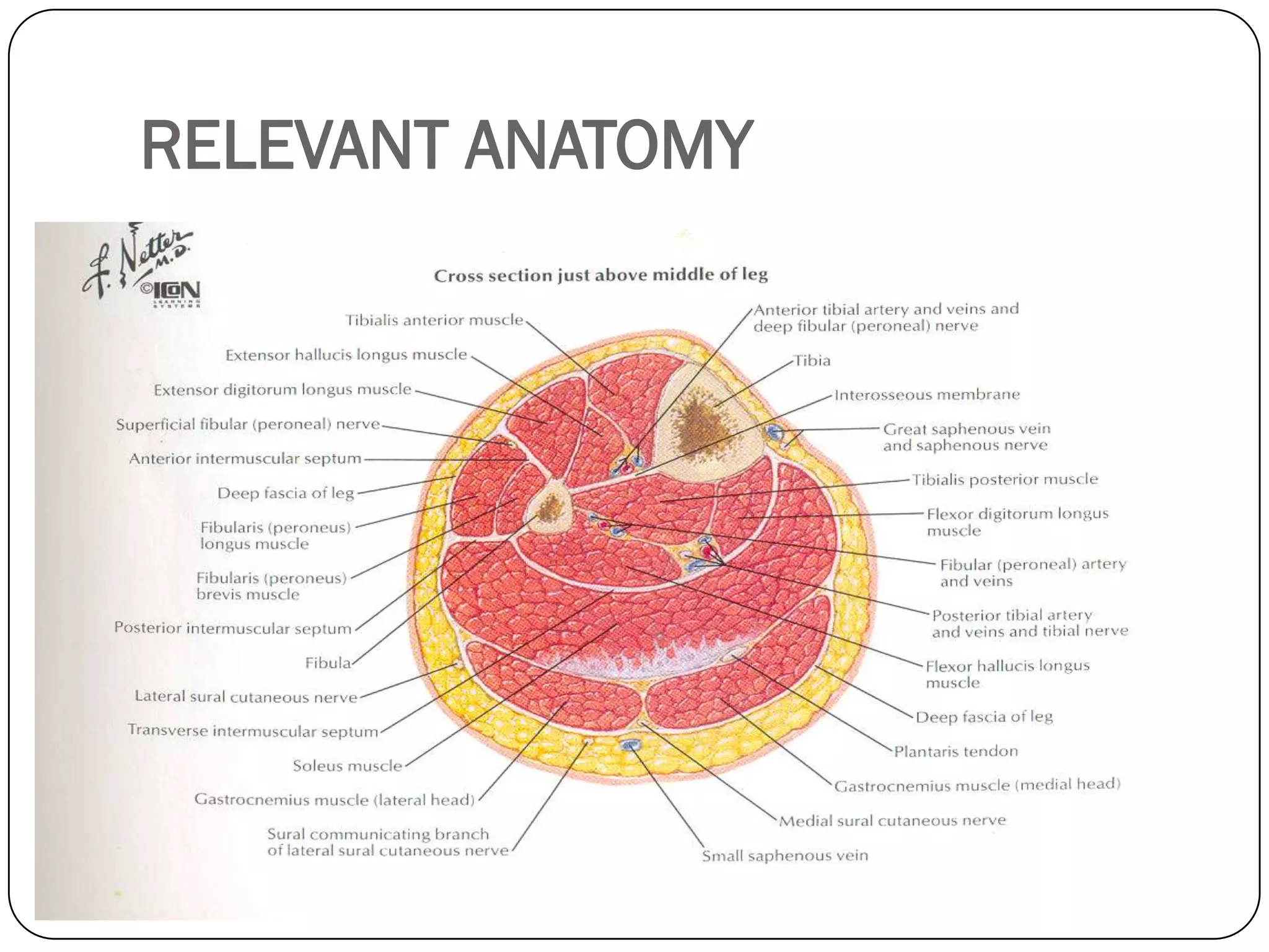 Below knee amputation | PPTX