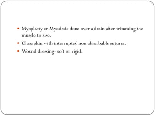 Below knee amputation | PPTX