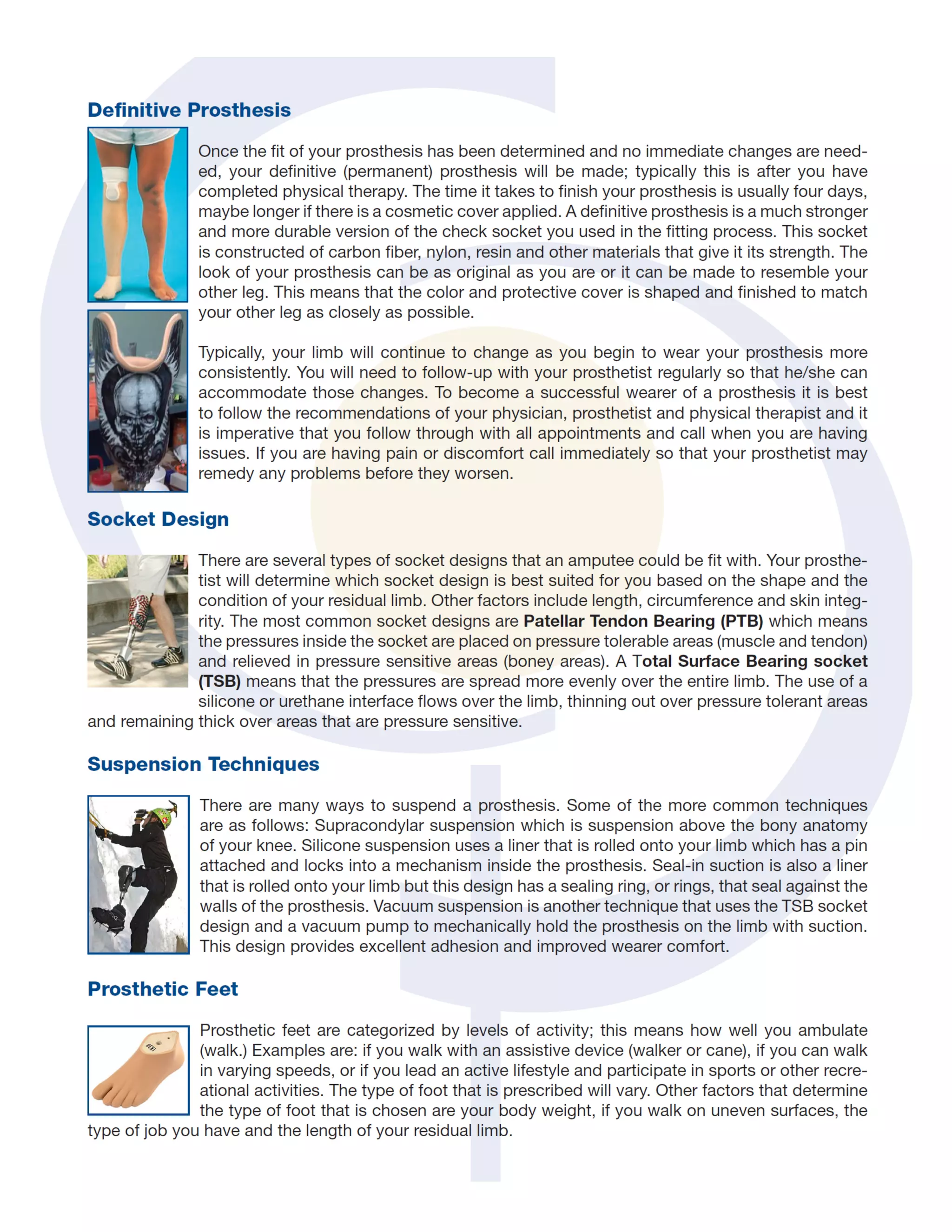 Below Knee Amputation An Overview of Prosthetic Care | PDF