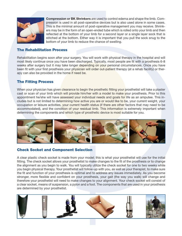 Below Knee Amputation An Overview of Prosthetic Care | PDF