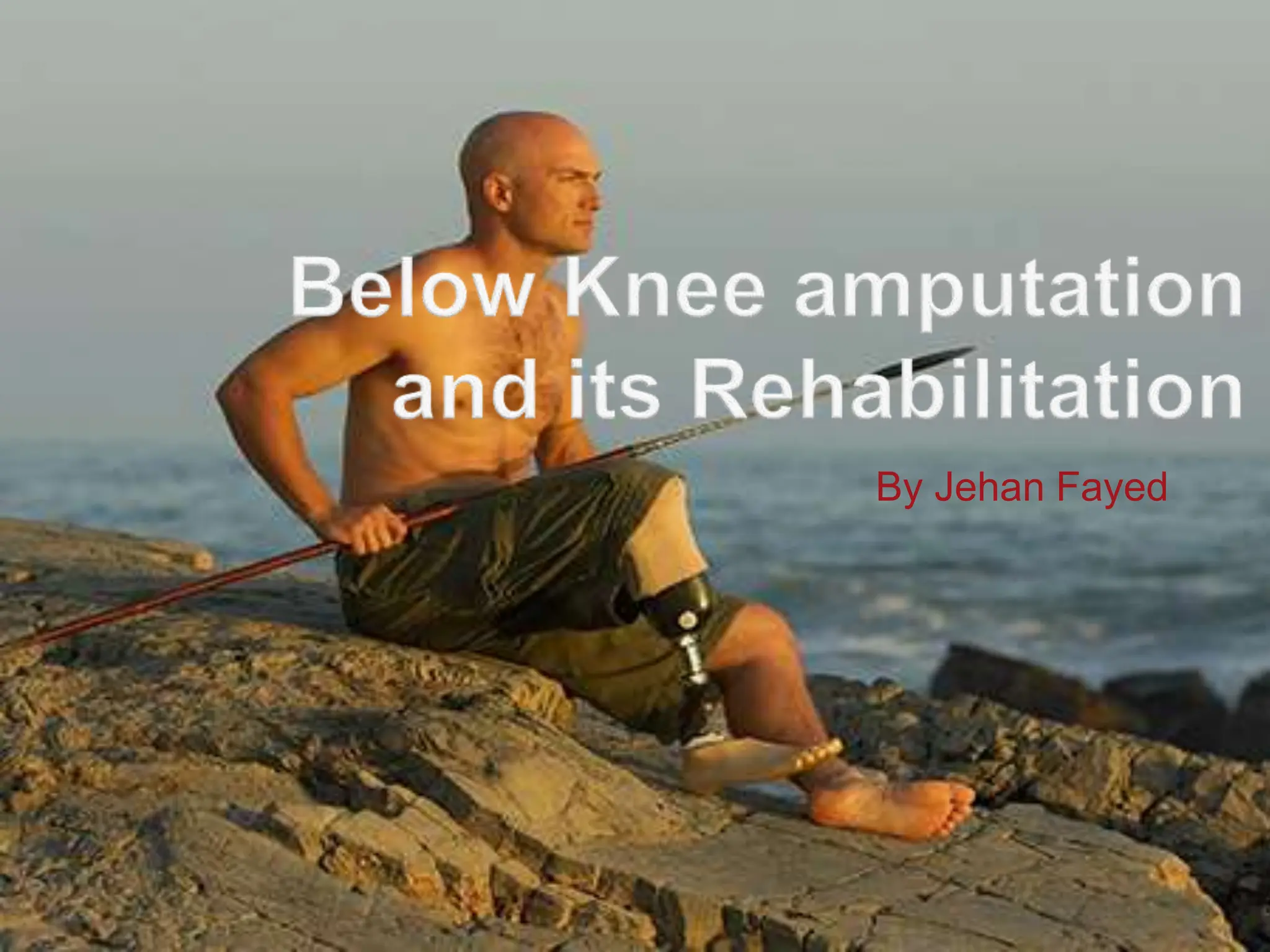 Below knee amputation and its Rehabilitation.pptx