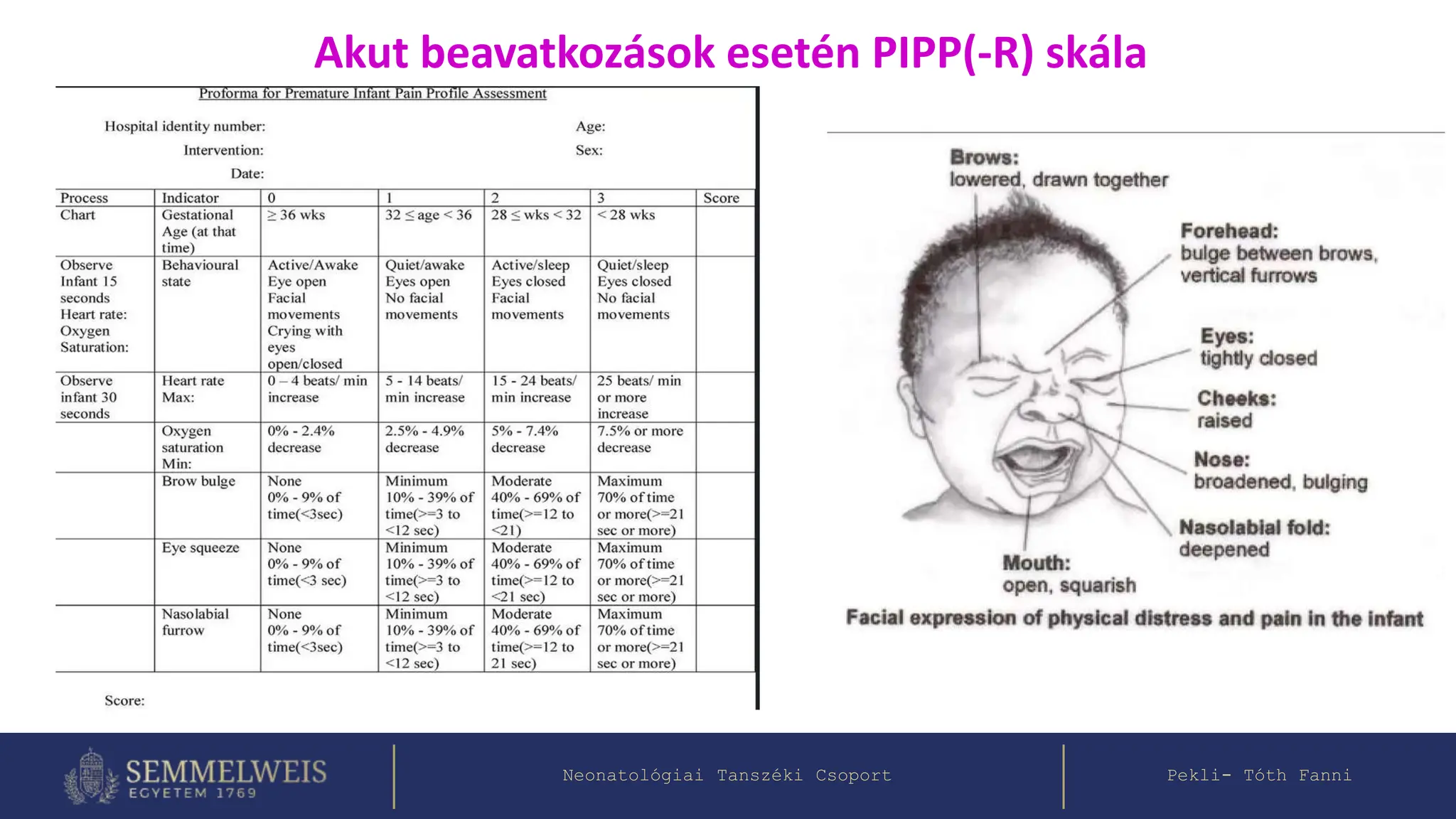 Neonatal pain - essentials | POTX