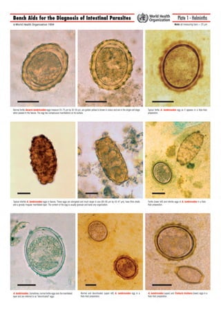 bench aids for the diagnosis of intestinal parasites1.pdf