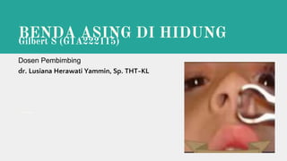 Benda Asing Hidung THT Gilbert Dicoba ajar | PPTX