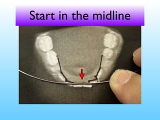Bending BWS primer | PPT