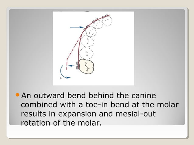 Bends | PPT | Dental Health | Diseases and Conditions