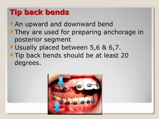 Bends | PPT
