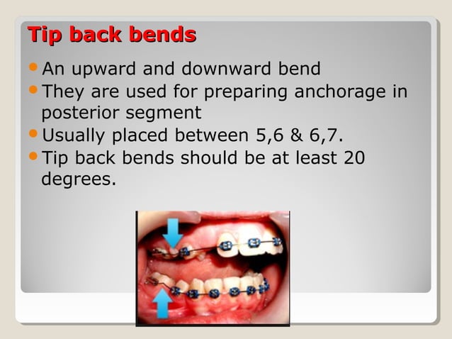 Bends | PPT | Dental Health | Diseases and Conditions