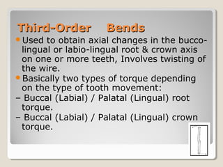 Bends | PPT