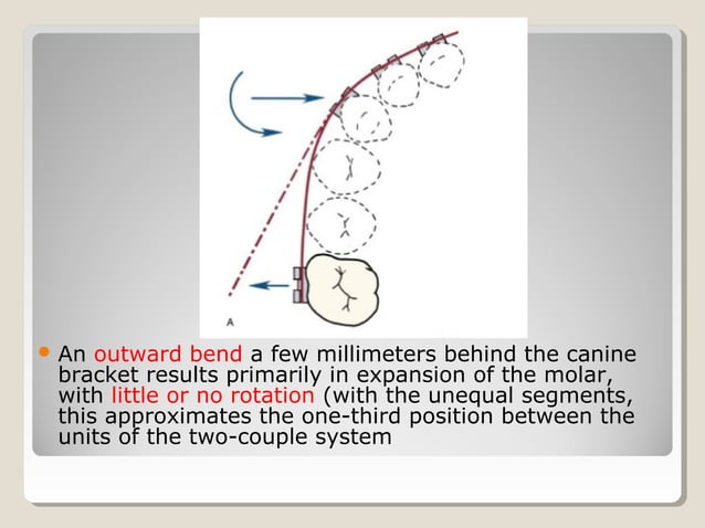 Bends | PPT | Dental Health | Diseases and Conditions