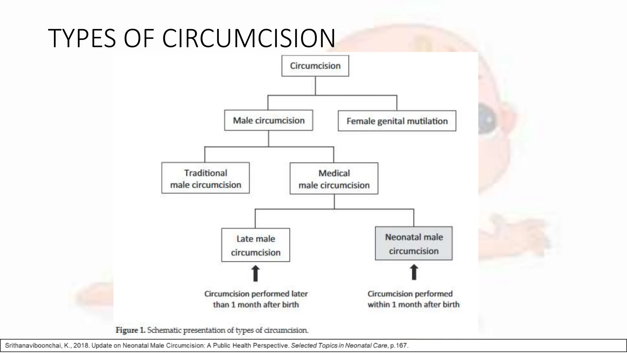 THE BENEFIT OF NEONATAL CIRCUMCISION.pptx