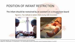 THE BENEFIT OF NEONATAL CIRCUMCISION.pptx