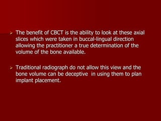 Benefits of cbct in implant planning | PPTX