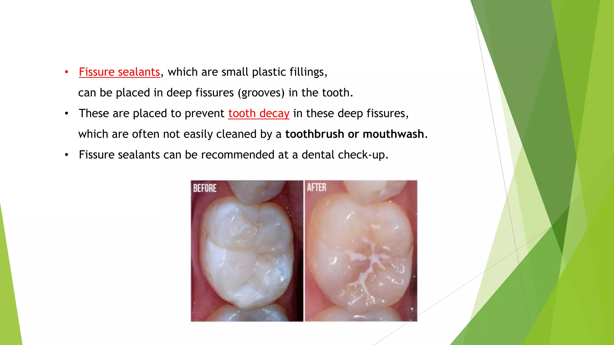 Benefits of regular dental checkup | PPTX