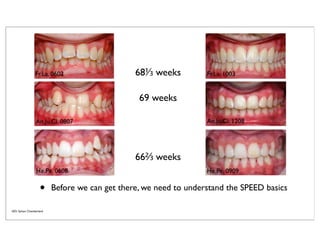 Benefits of SPEED bracket_Getting to Know the SPEED Appliance | PDF