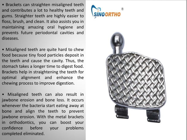 Benefits of the Orthodontic Brackets That You Are Not Aware Of! | PPTX | Dental Health ...